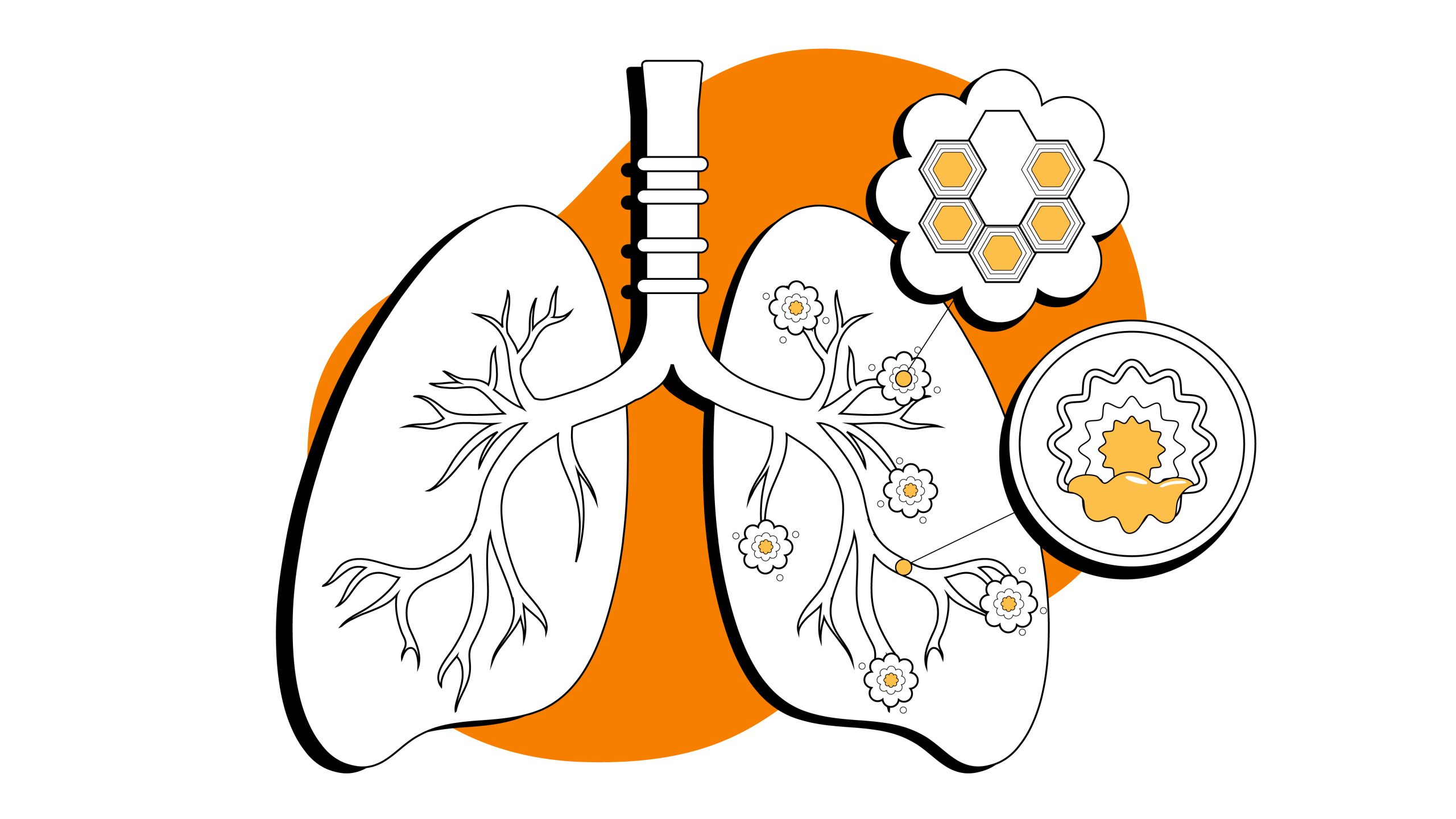 COPD Statistics & Facts in the US (2023)