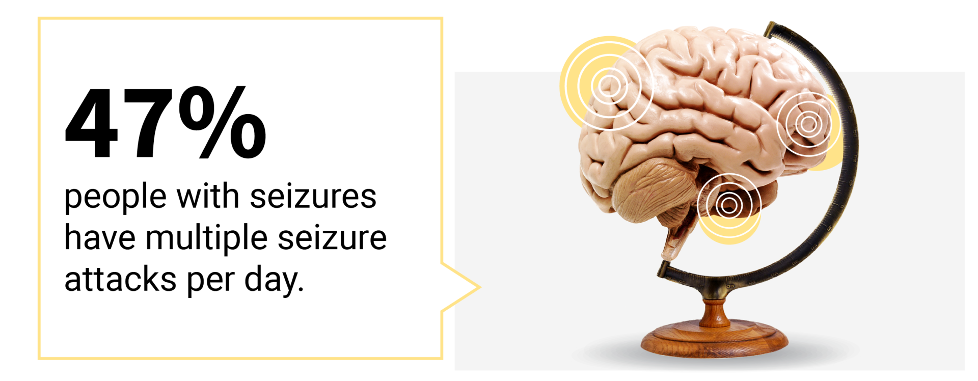 Epilepsy Statistics: How Many People Have Epilepsy in the US? - CFAH